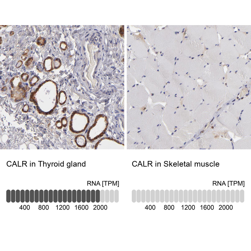 Rabbit Polyclonal Anti-CALR Antibody - Buy for research - Highly ...