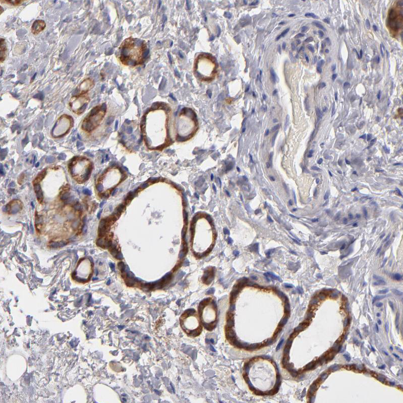 Rabbit Polyclonal Anti-CALR Antibody - Buy for research - Highly ...