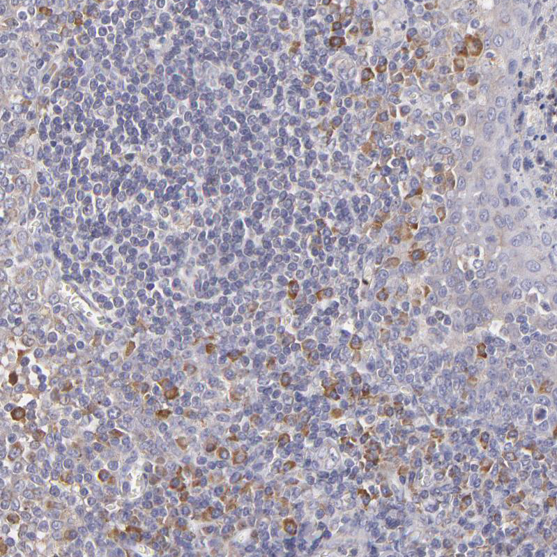 Rabbit Polyclonal Anti-CALR Antibody - Buy for research - Highly ...