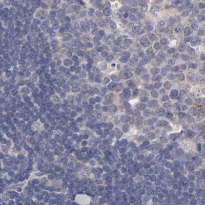 Rabbit Polyclonal Anti-SLMAP Antibody - Buy for research - Highly ...
