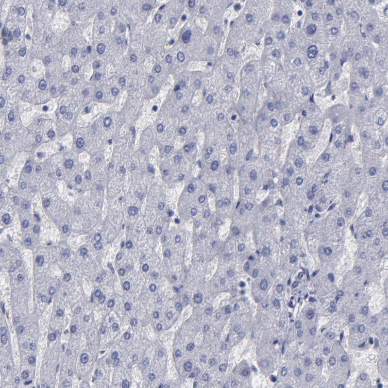 Rabbit Polyclonal Anti-SLMAP Antibody - Buy for research - Highly ...