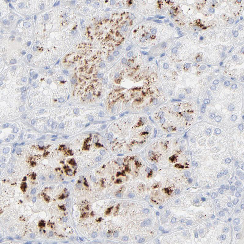 Rabbit Polyclonal Anti-LCN2 Antibody - Buy for research - Highly ...