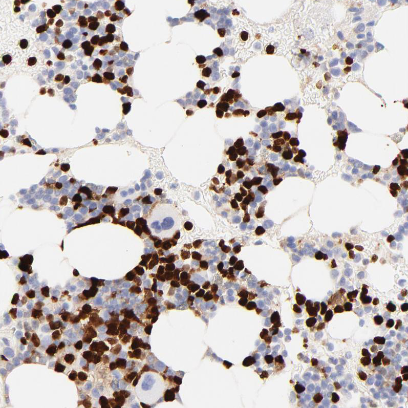 Rabbit Polyclonal Anti-S100A12 Antibody - Buy for research - Highly ...