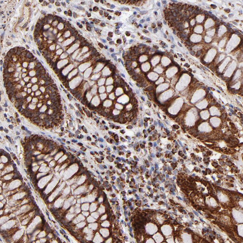 Rabbit Polyclonal Anti-DLST Antibody - Buy for research - Highly ...