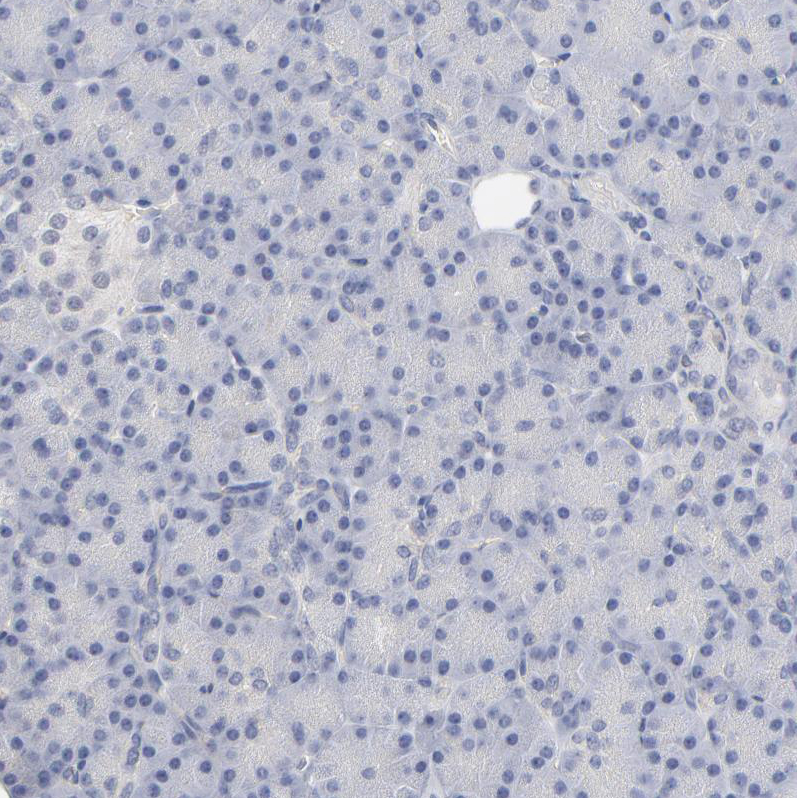 Rabbit Polyclonal Anti-SLC16A1 Antibody - Buy for research - Highly ...
