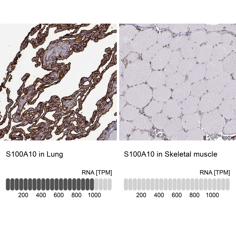 Rabbit Polyclonal Anti-S100A10 Antibody - Buy for research - Highly ...