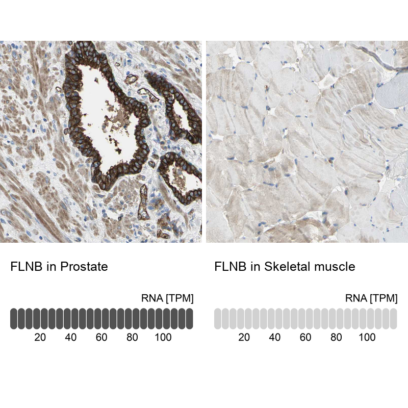 Rabbit Polyclonal Anti-FLNB Antibody - Buy for research - Highly ...