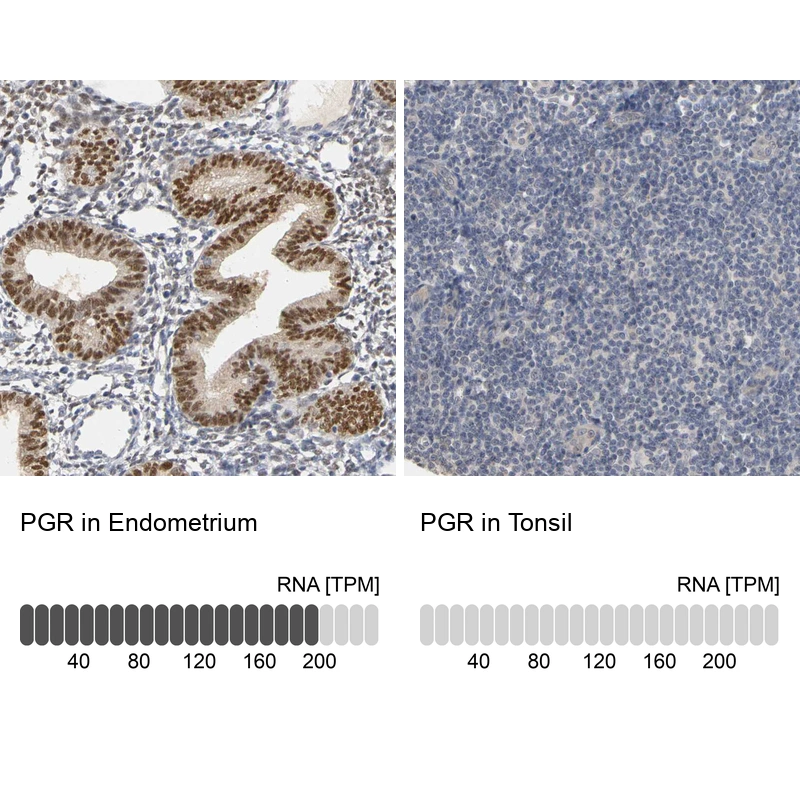Rabbit Polyclonal Anti-PGR Antibody - Buy for research - Highly ...