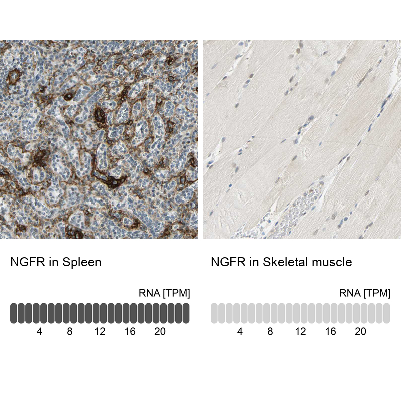 Rabbit Polyclonal Anti-NGFR Antibody - Buy for research - Highly ...