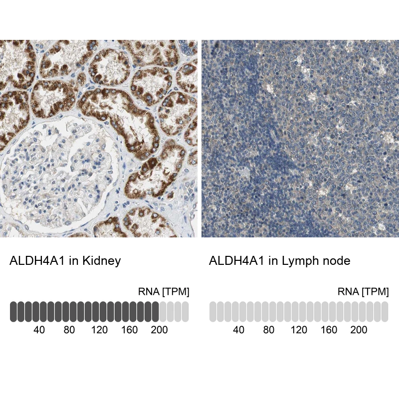 Rabbit Polyclonal Anti-ALDH4A1 Antibody - Buy for research - Highly ...