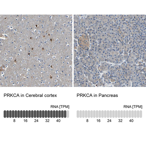 Anti-PRKCA Human Protein Atlas Antibody