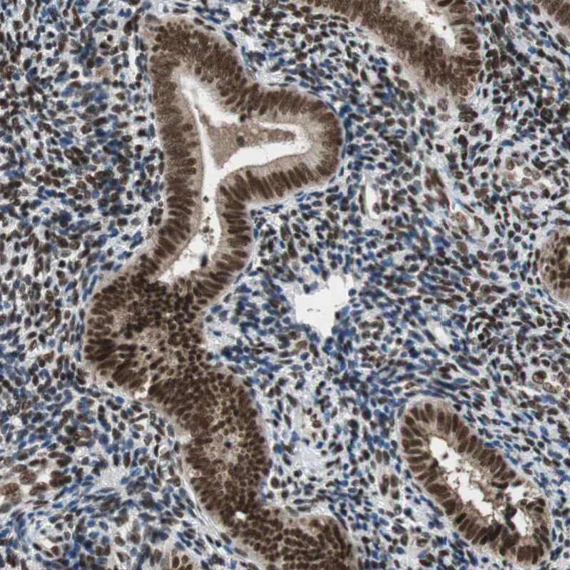 Rabbit Polyclonal Anti-CHAMP1 Antibody - Buy for research - Highly ...