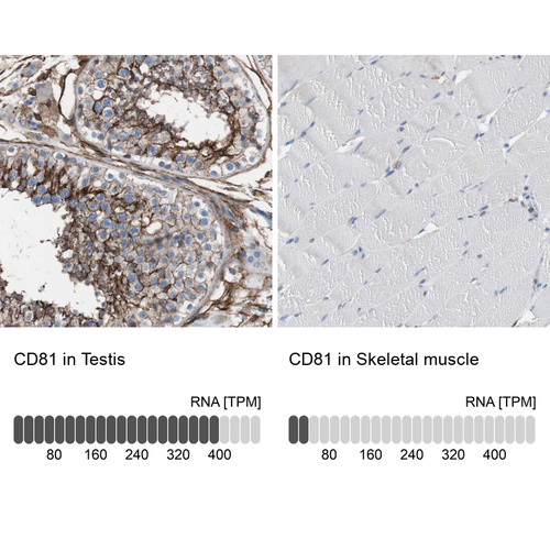 Rabbit Polyclonal Anti-CD81 Antibody - Buy for research - Highly specific, rigorously validated ...