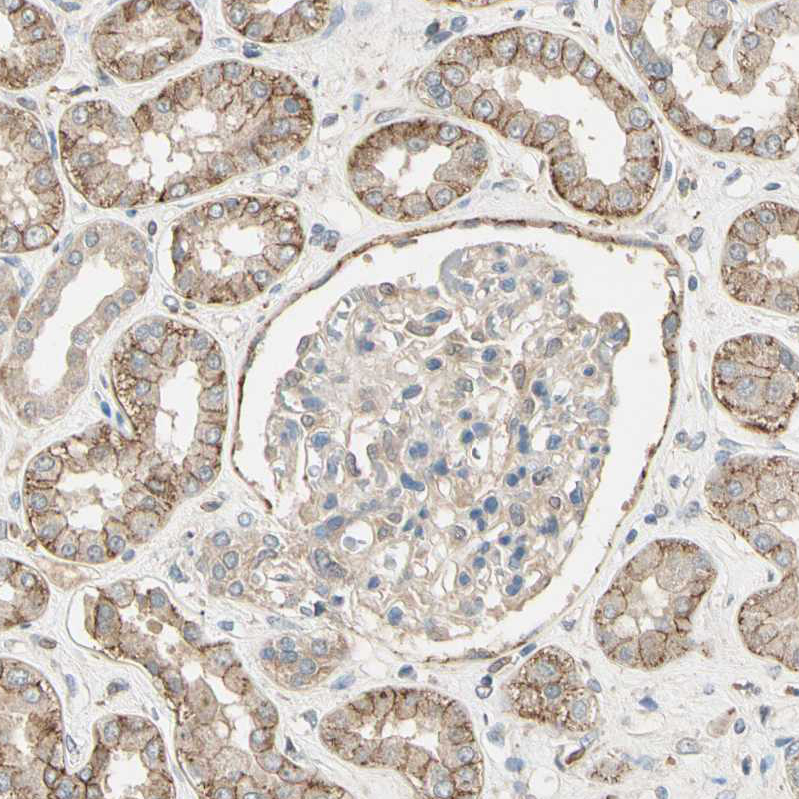 Rabbit Polyclonal Anti-CDH6 Antibody - Buy for research - Highly ...