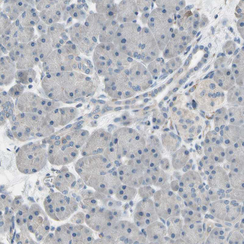 Rabbit Polyclonal Anti-CDH6 Antibody - Buy for research - Highly ...