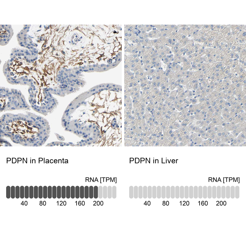 Rabbit Polyclonal Anti-PDPN Antibody - Buy for research - Highly ...
