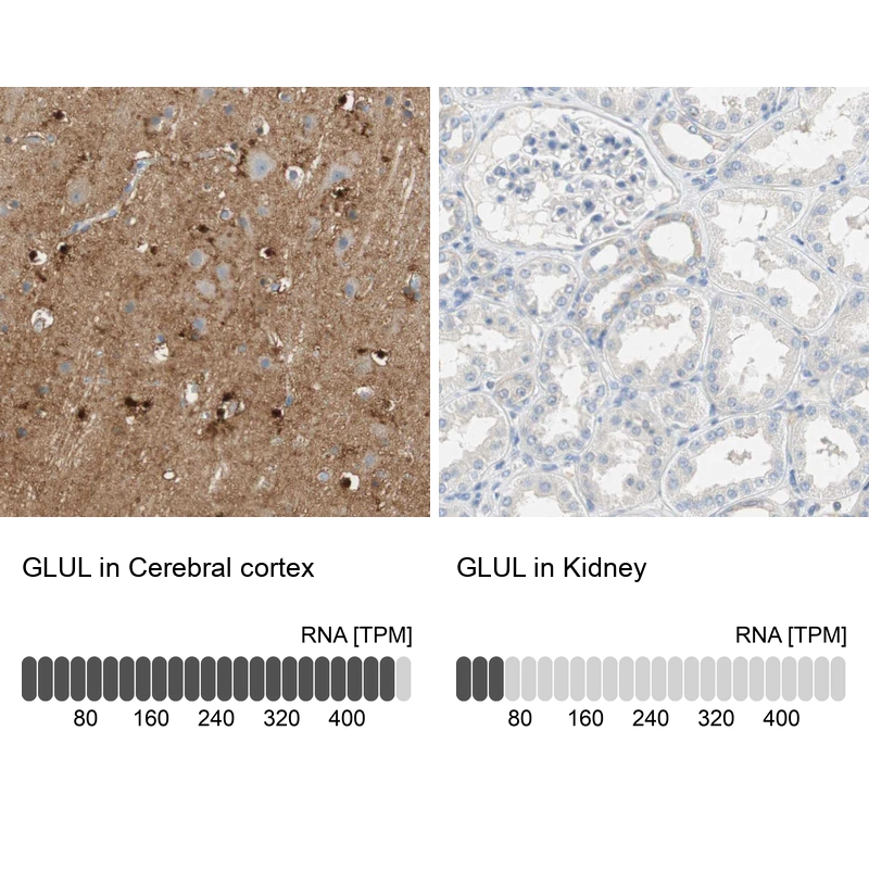 Rabbit Polyclonal Anti-GLUL Antibody - Buy for research - Highly ...