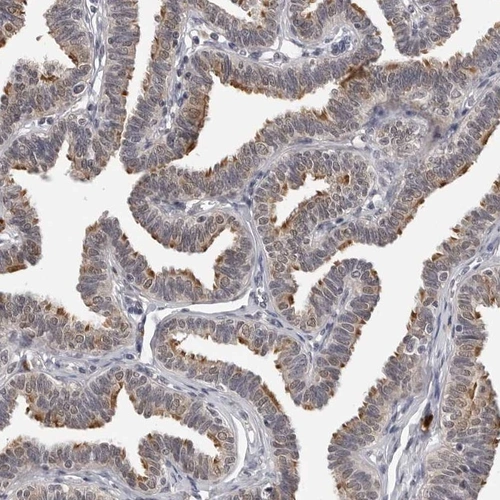 Rabbit Polyclonal Anti-CDK20 Antibody - Buy for research - Highly ...