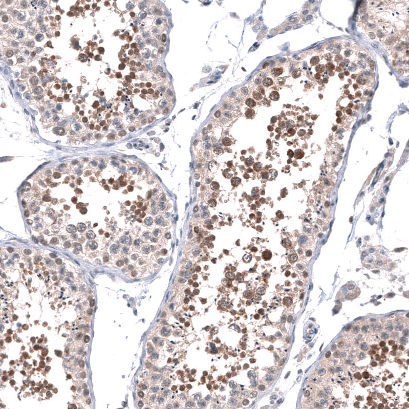 Rabbit Polyclonal Anti-MAPK13 Antibody - Buy for research - Highly ...