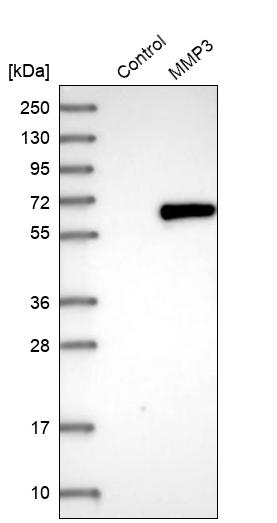 Rabbit Polyclonal Anti-MMP3 Antibody - Buy for research - Highly ...