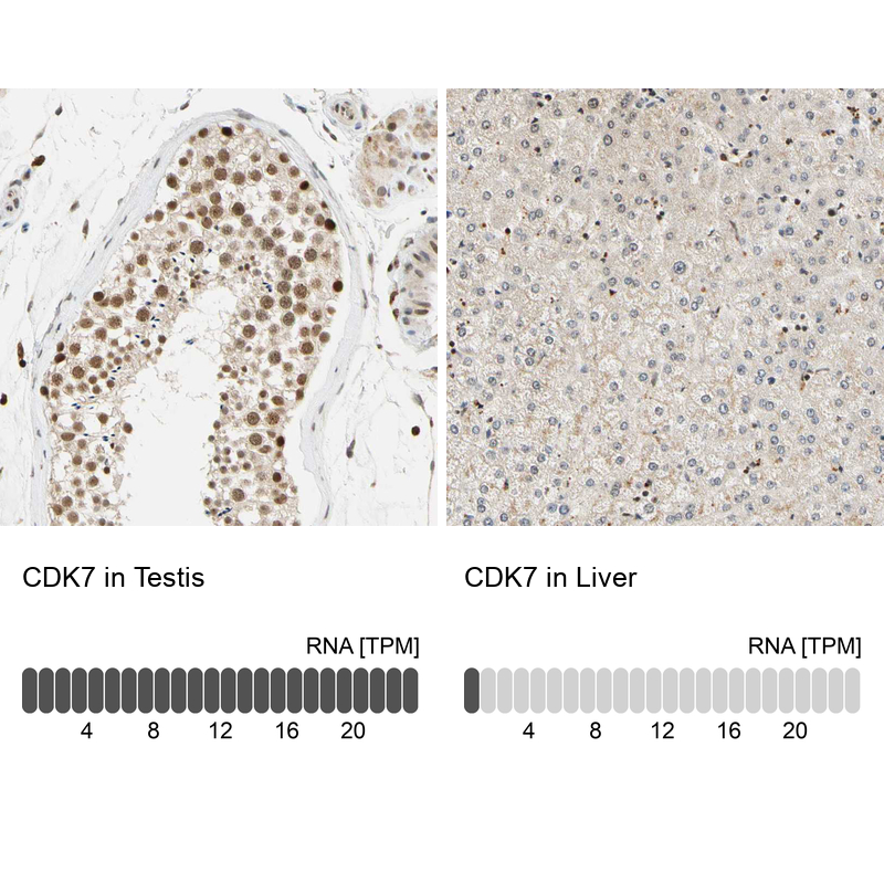 Rabbit Polyclonal Anti-CDK7 Antibody - Buy for research - Highly ...