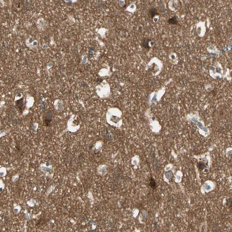 Rabbit Polyclonal Anti-NAPG Antibody - Buy for research - Highly ...