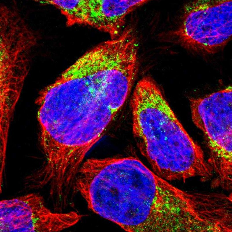 Rabbit Polyclonal Anti-MCCC1 Antibody - Buy for research - Highly ...