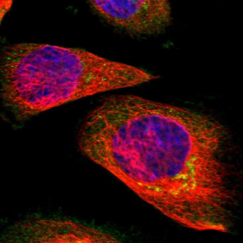 Rabbit Polyclonal Anti-SUN3 Antibody - Buy for research - Highly ...