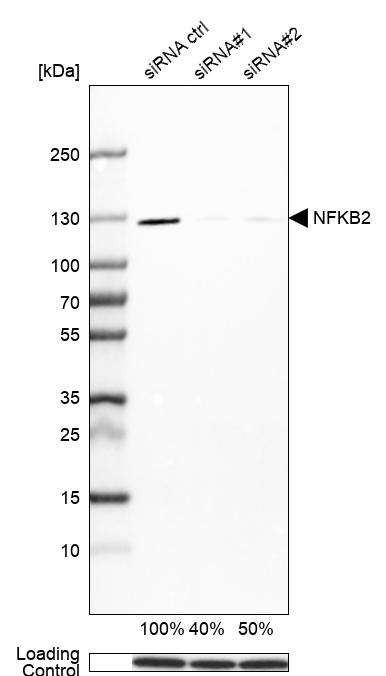 Rabbit Polyclonal Anti-NFKB2 Antibody - Buy for research - Highly ...