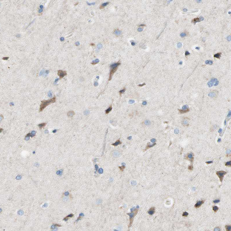 Rabbit Polyclonal Anti-CA14 Antibody - Buy for research - Highly ...