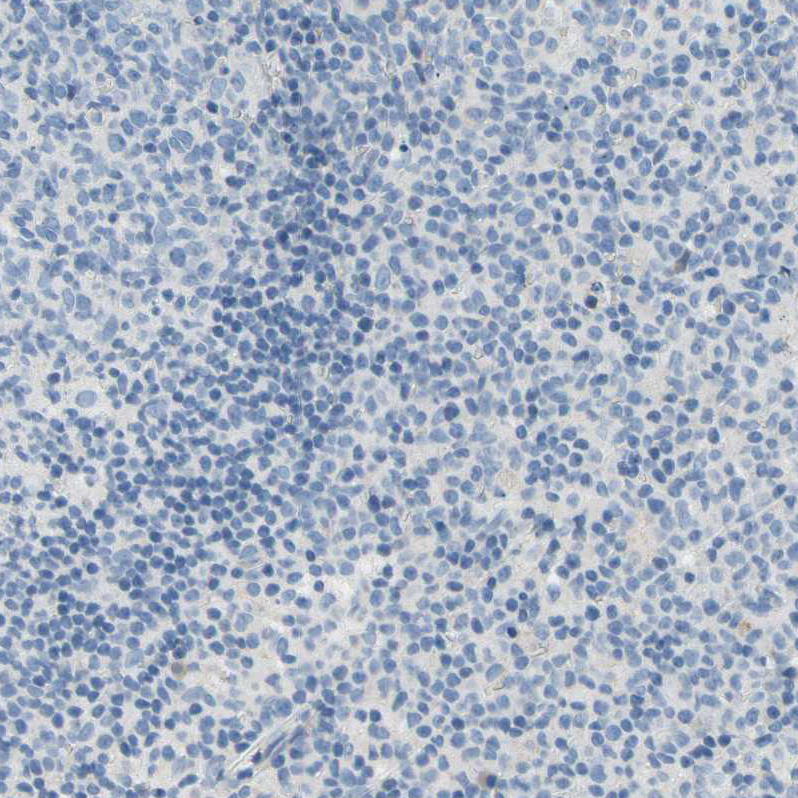 Rabbit Polyclonal Anti-CA14 Antibody - Buy for research - Highly ...
