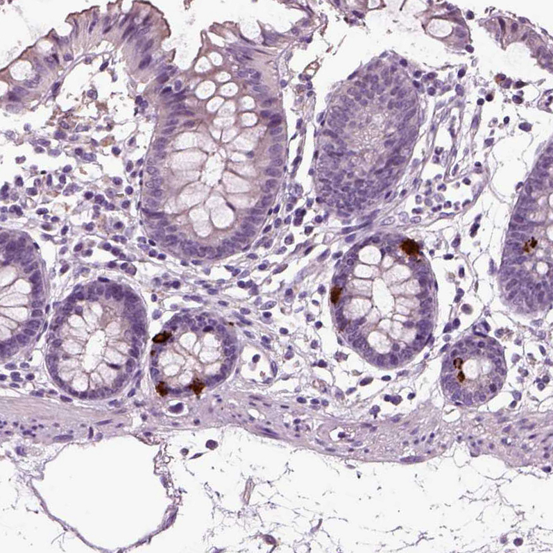 Rabbit Polyclonal Anti-CHGB Antibody - Buy for research - Highly ...