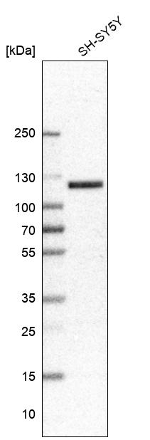 Rabbit Polyclonal Anti-CHGB Antibody - Buy for research - Highly ...