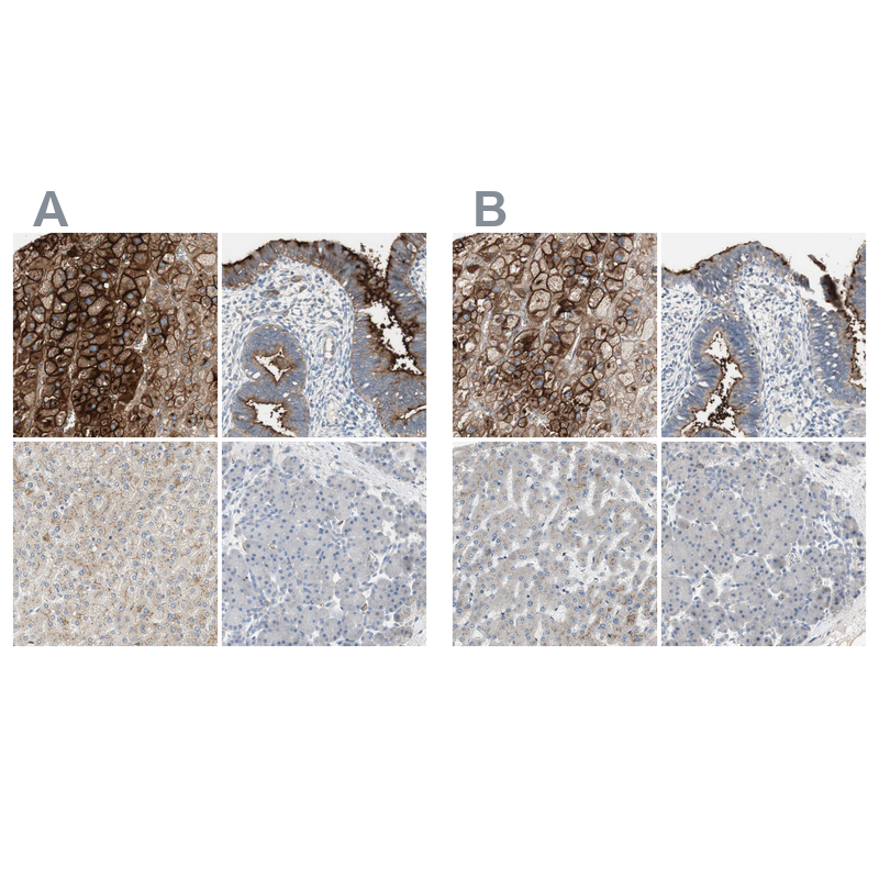 Rabbit Polyclonal Anti-ALPL Antibody - Buy for research - Highly ...