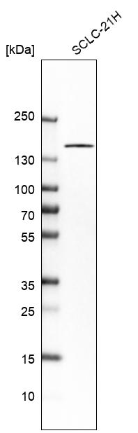 Rabbit Polyclonal Anti-TP53BP1 Antibody - Buy for research - Highly specific, rigorously ...