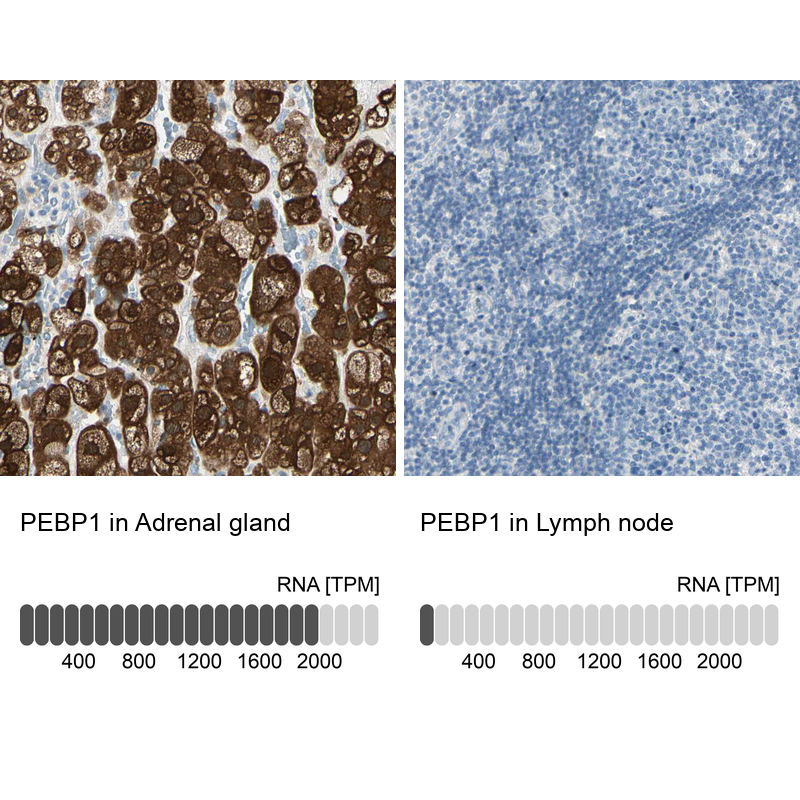 Rabbit Polyclonal Anti-PEBP1 Antibody - Buy for research - Highly ...