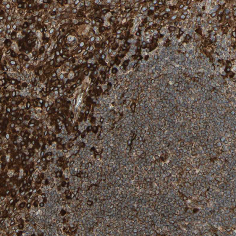 Rabbit Polyclonal Anti-CANX Antibody - Buy for research - Highly ...