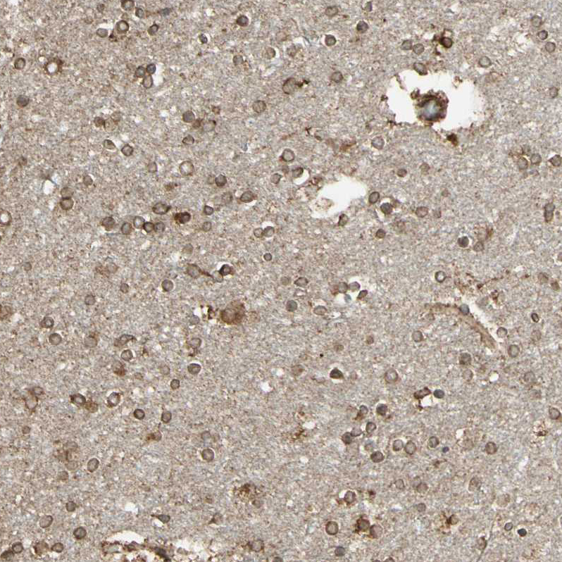 Rabbit Polyclonal Anti-CANX Antibody - Buy for research - Highly ...