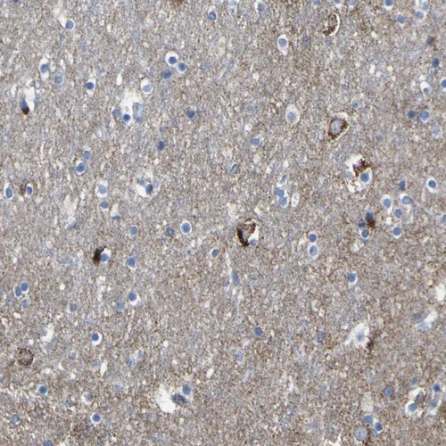 Anti-HK1 Human Protein Atlas Antibody