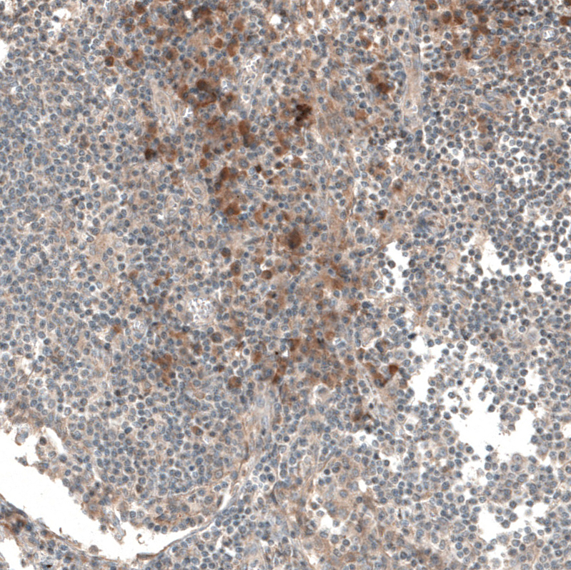 Rabbit Polyclonal Anti-CSF1R Antibody - Buy for research - Highly specific, rigorously validated ...