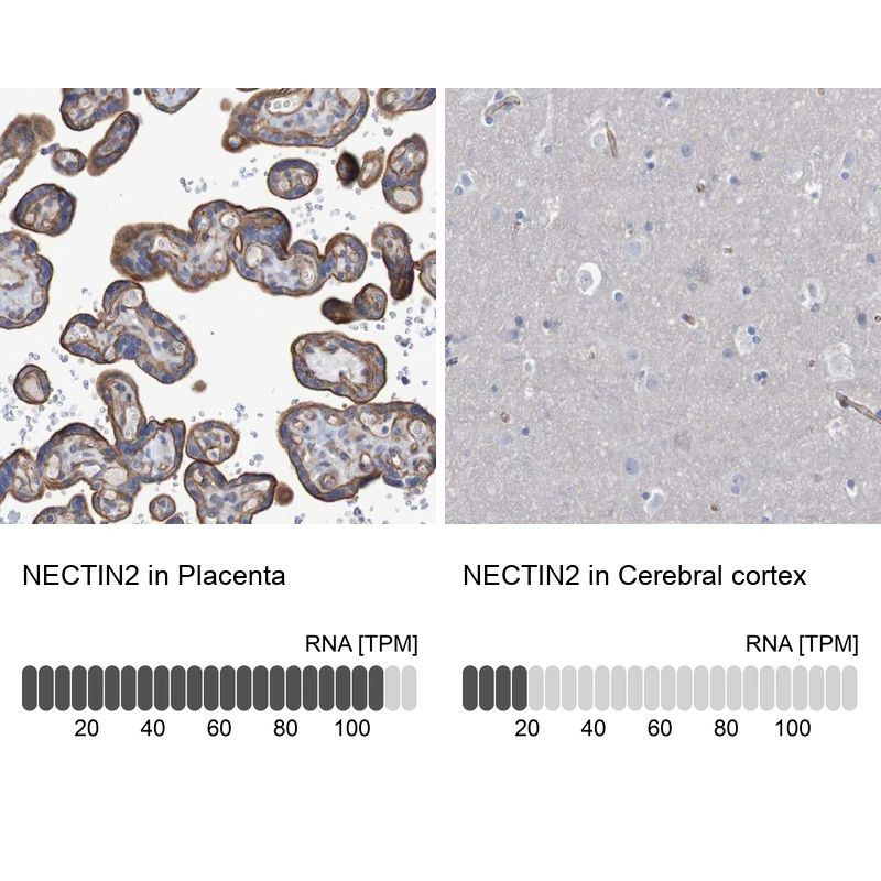 Rabbit Polyclonal Anti-NECTIN2 Antibody - Buy for research - Highly ...