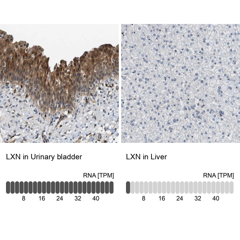 Rabbit Polyclonal Anti-LXN Antibody - Buy for research - Highly ...