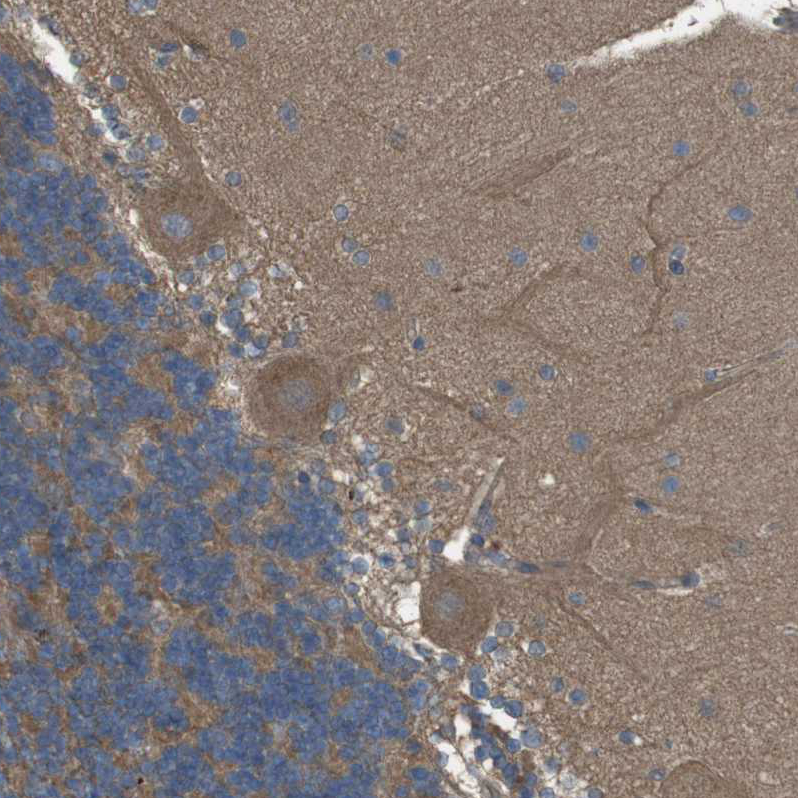 Rabbit Polyclonal Anti-ZDHHC20 Antibody - Buy for research - Highly ...