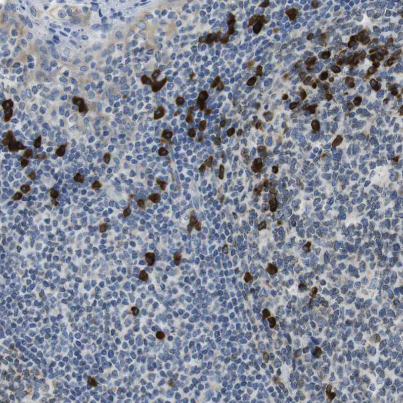 Rabbit Polyclonal Anti-CLPTM1L Antibody - Buy for research - Highly ...