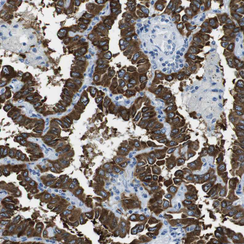 Rabbit Polyclonal Anti-CLPTM1L Antibody - Buy for research - Highly ...