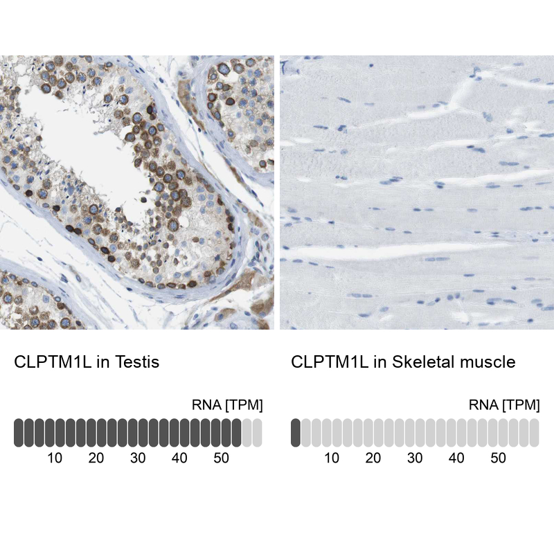 Rabbit Polyclonal Anti-CLPTM1L Antibody - Buy for research - Highly ...