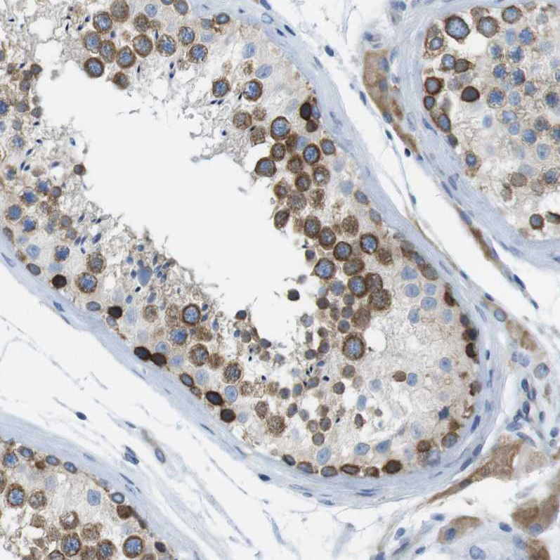 Rabbit Polyclonal Anti-CLPTM1L Antibody - Buy for research - Highly ...