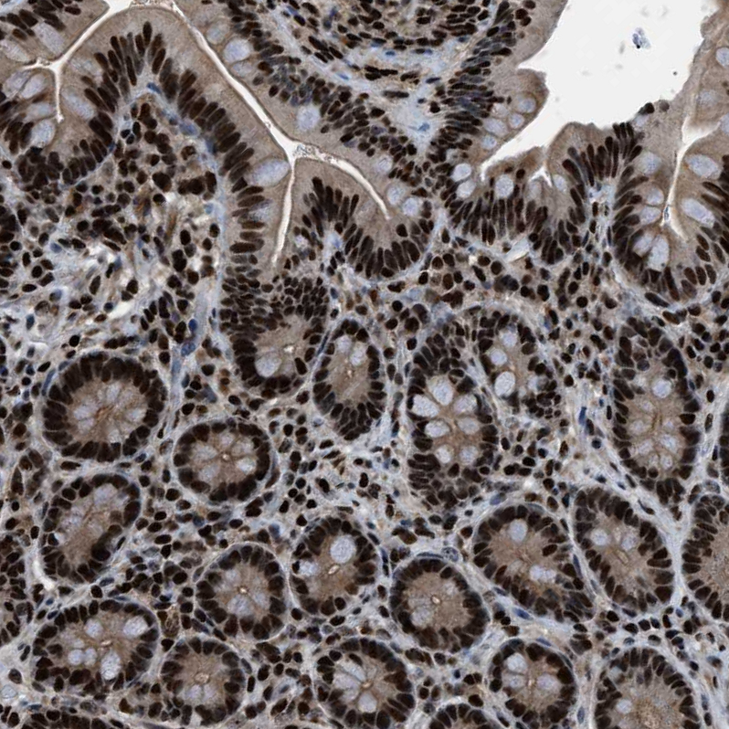 Rabbit Polyclonal Anti-PRKX Antibody - Buy for research - Highly specific, rigorously validated ...