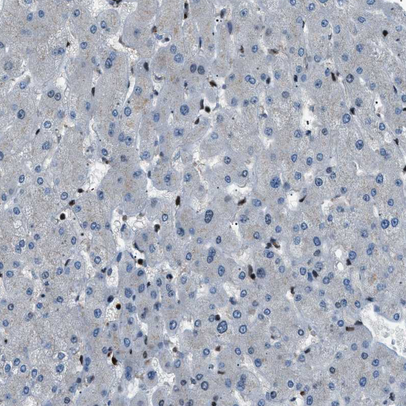 Rabbit Polyclonal Anti-PRKX Antibody - Buy for research - Highly specific, rigorously validated ...