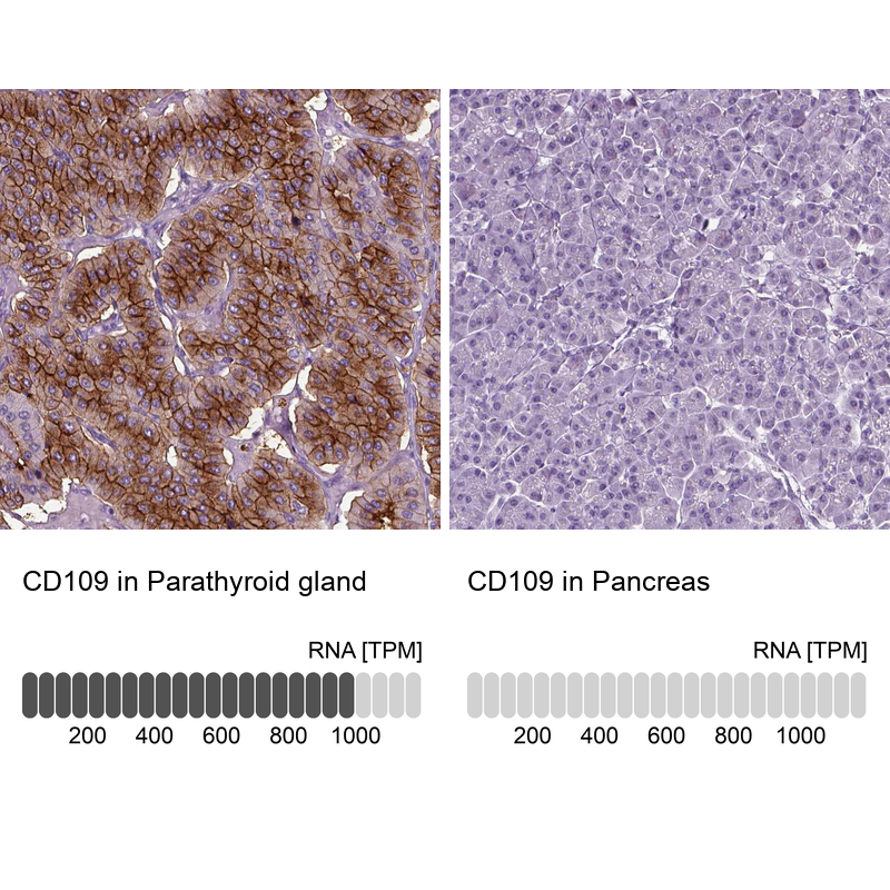 Rabbit Polyclonal Anti-CD109 Antibody - Buy for research - Highly ...